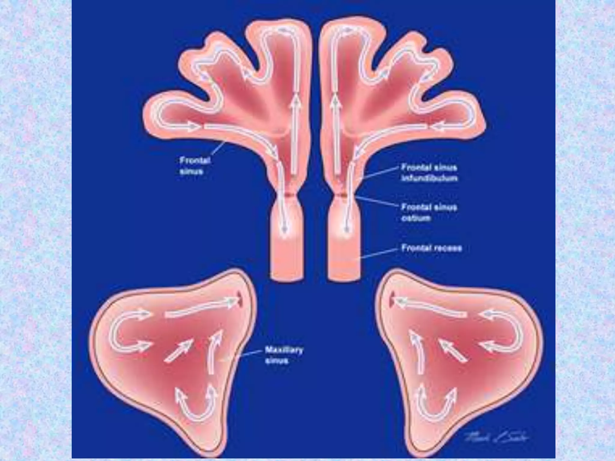 Surgical anatomy of Maxillary Sinus , Lateral wall of nose and Soft ...