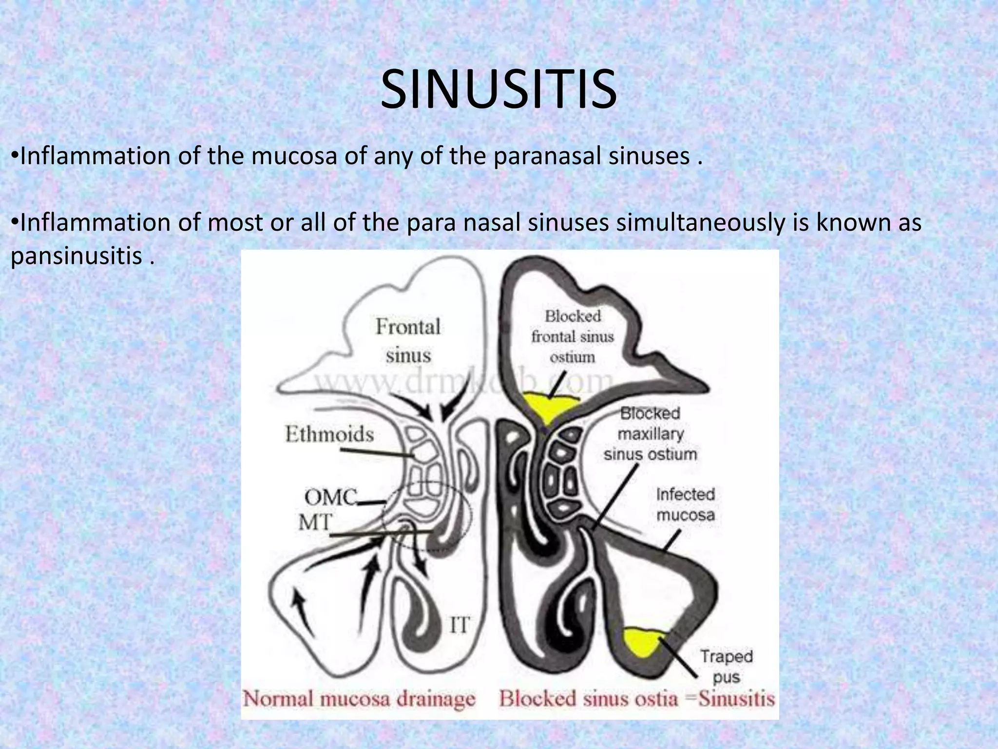 Surgical anatomy of Maxillary Sinus , Lateral wall of nose and Soft ...