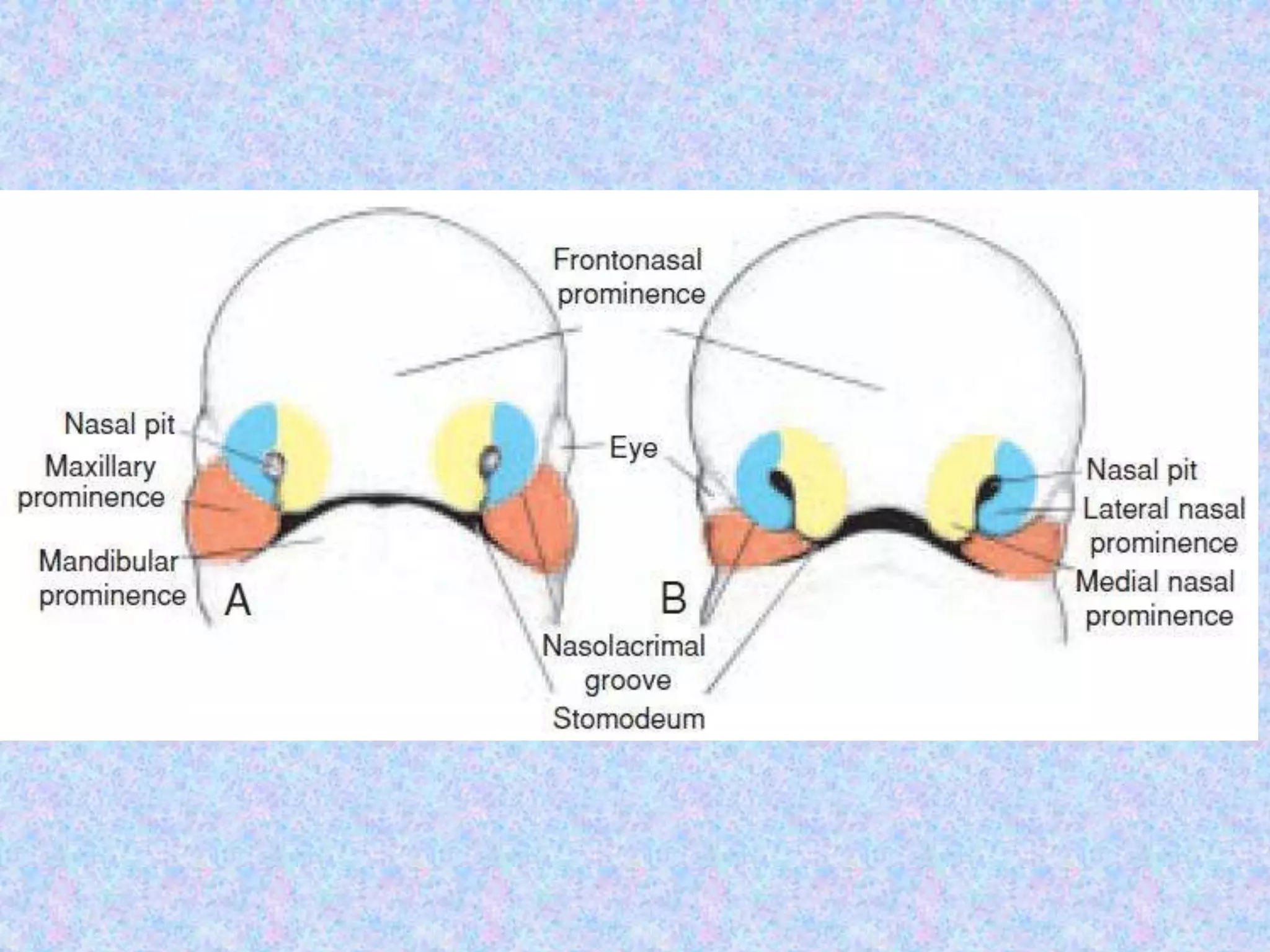 Surgical anatomy of Maxillary Sinus , Lateral wall of nose and Soft ...