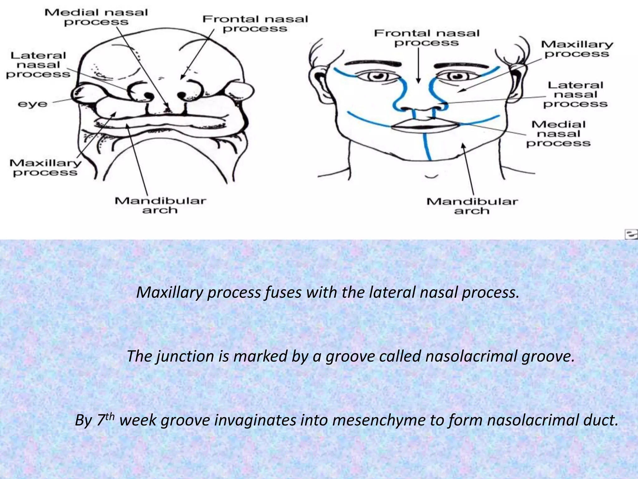 Surgical anatomy of Maxillary Sinus , Lateral wall of nose and Soft ...