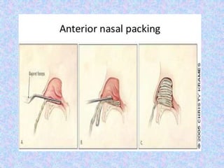 Surgical anatomy of Maxillary Sinus , Lateral wall of nose and Soft ...