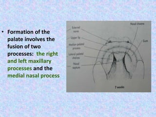 Surgical anatomy of Maxillary Sinus , Lateral wall of nose and Soft ...
