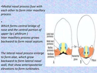 Surgical anatomy of Maxillary Sinus , Lateral wall of nose and Soft ...