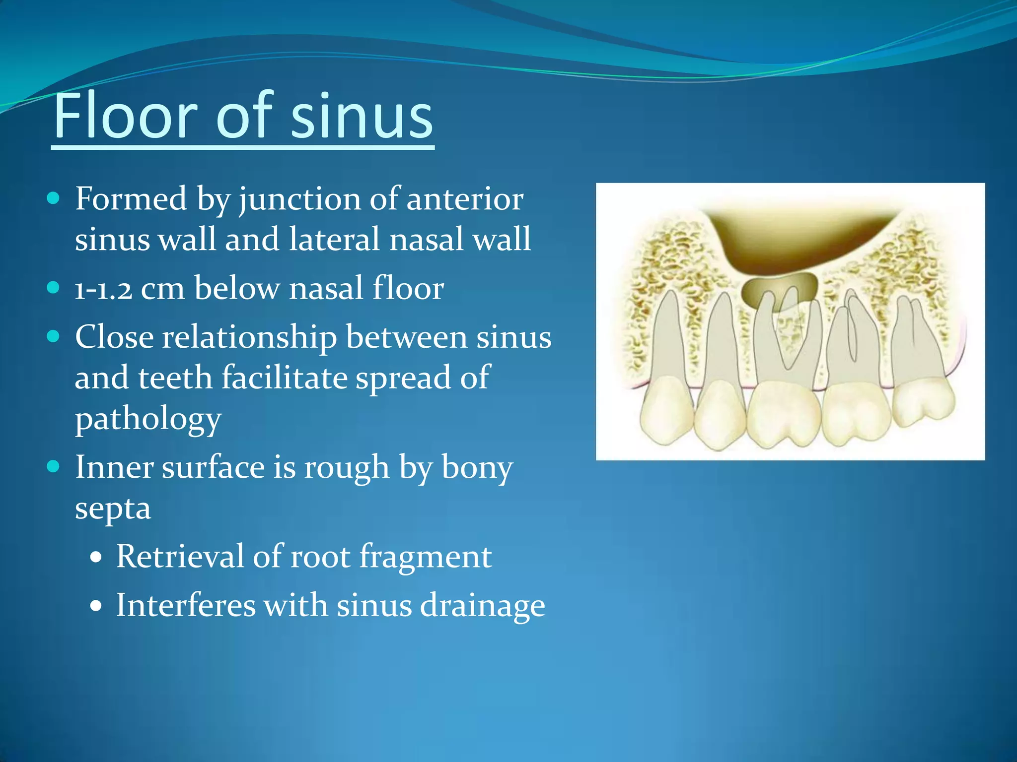 Surgical anatomy of maxillary sinus – note on (2) | PPTX