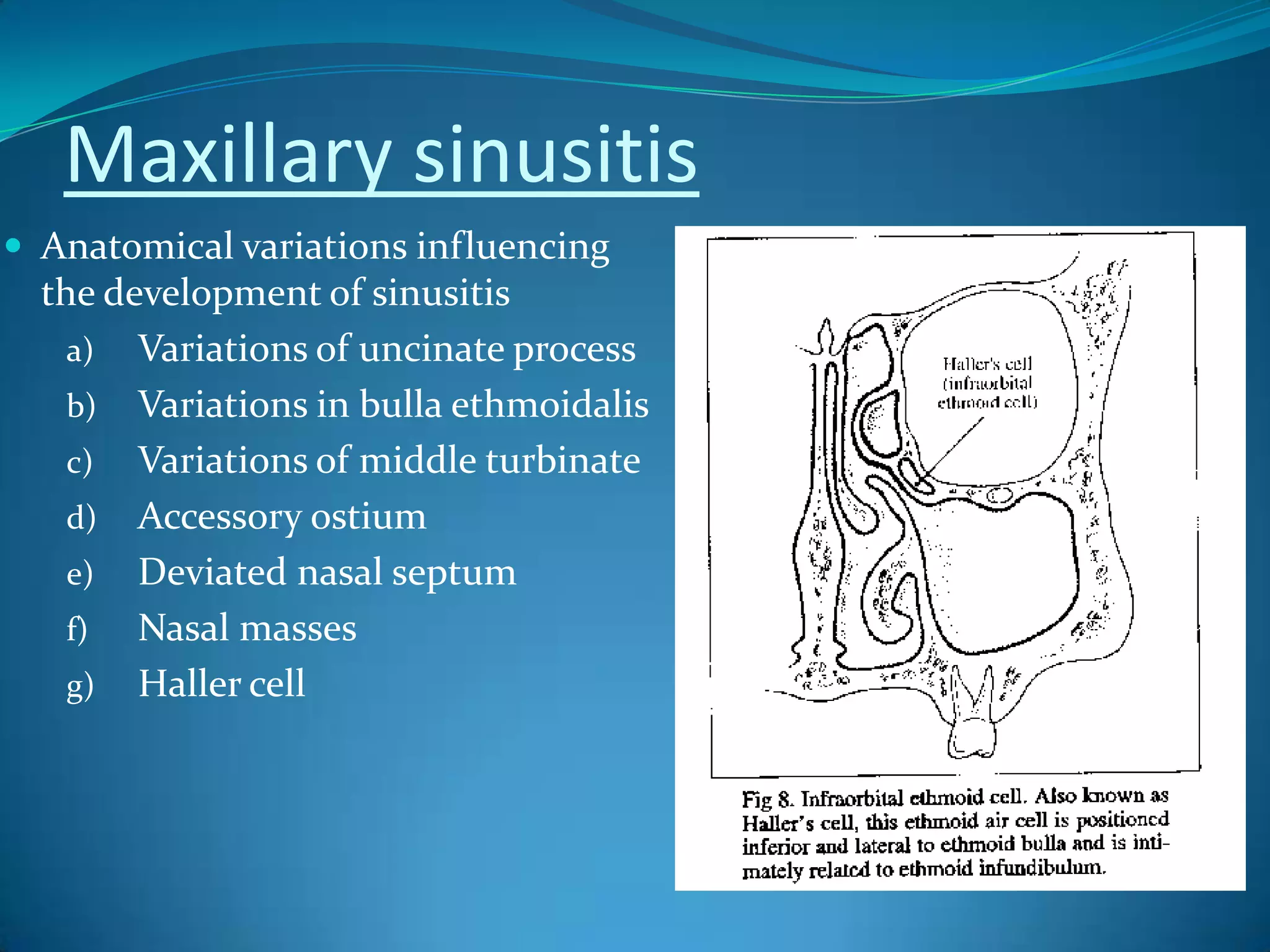 Surgical anatomy of maxillary sinus – note on (2) | PPTX
