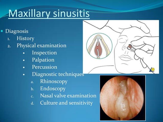 Surgical anatomy of maxillary sinus – note on (2) | PPTX