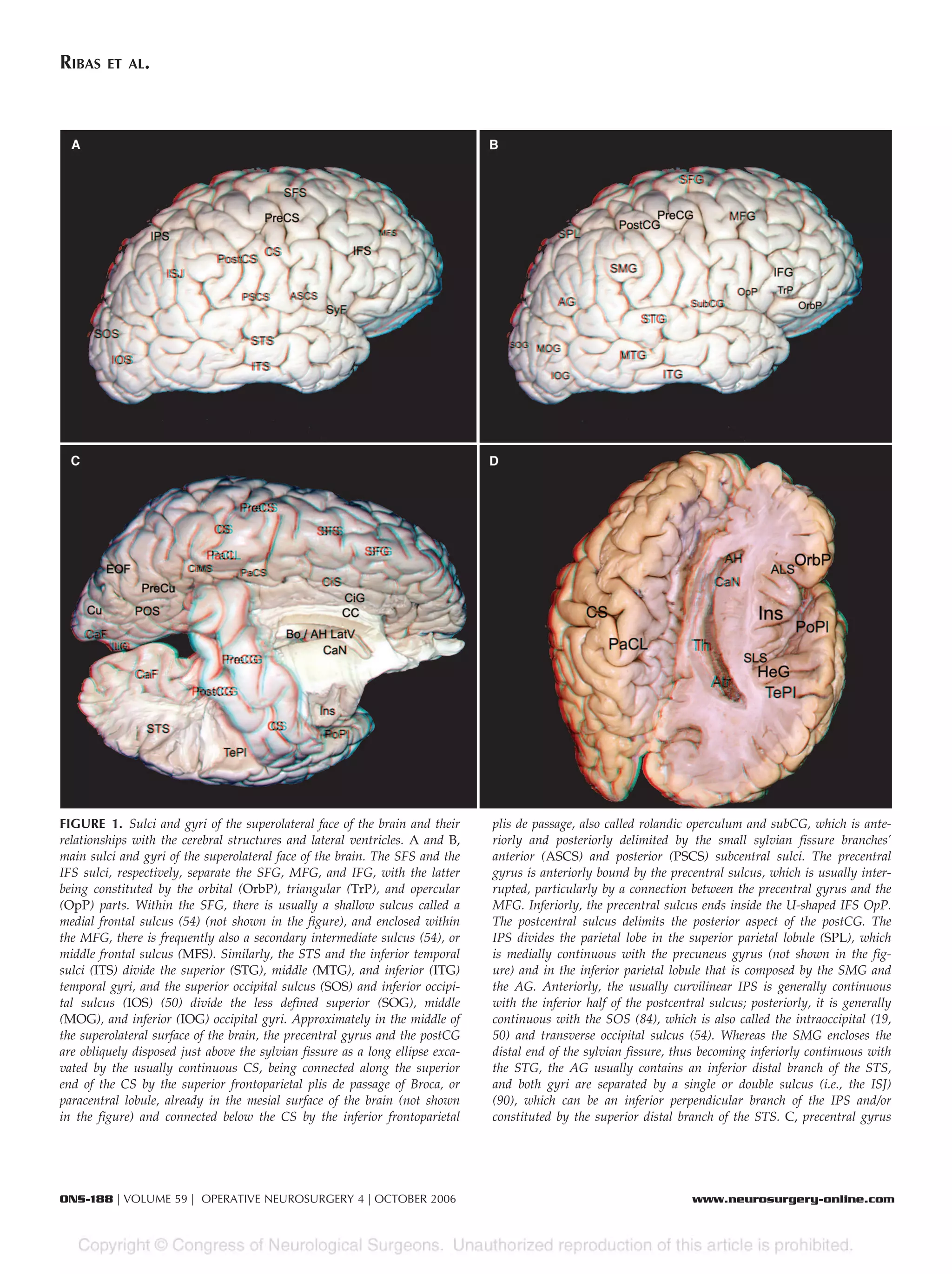 Surgical anatomy of microsurgical sulcal key points | PDF