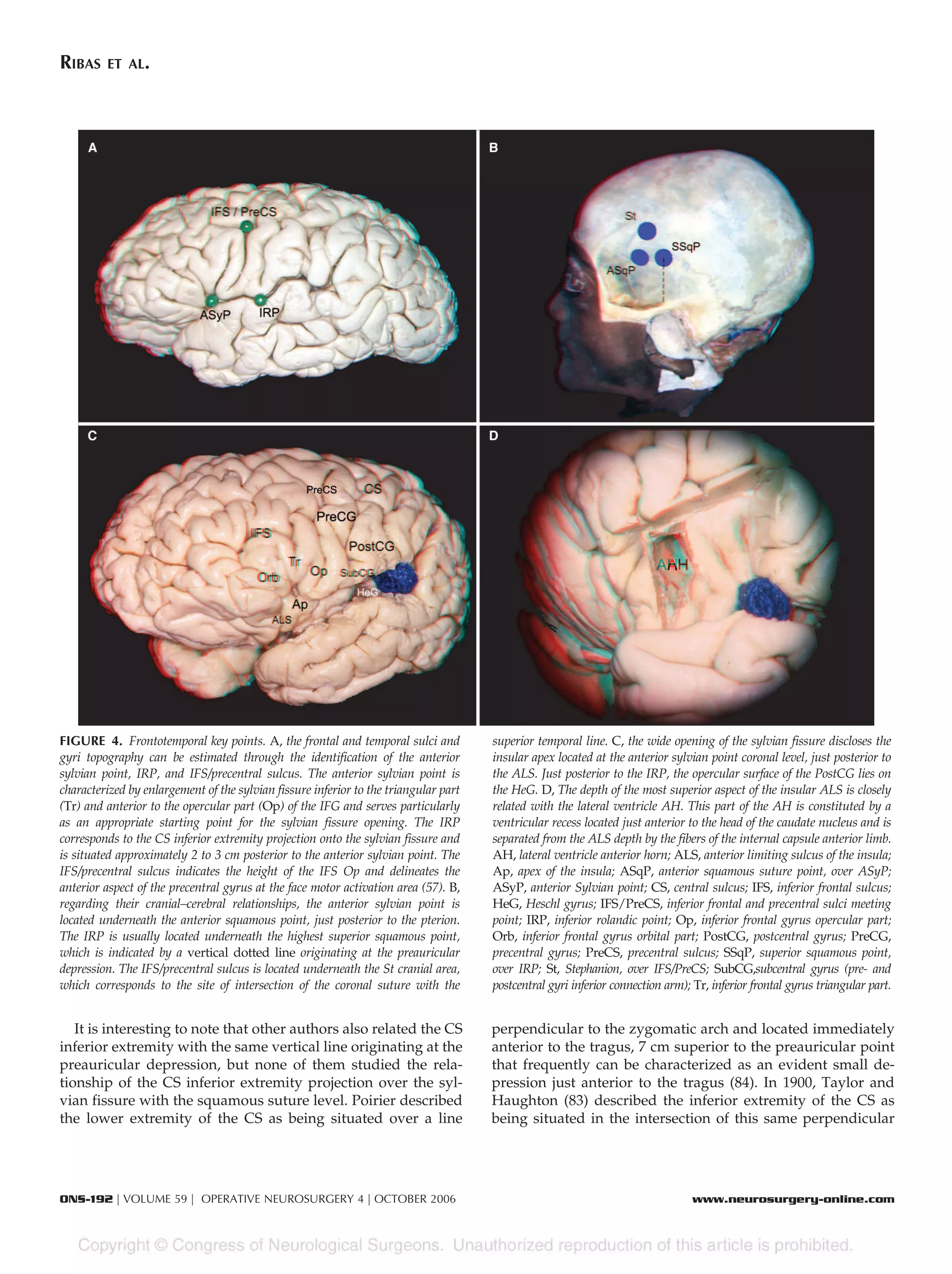 Surgical anatomy of microsurgical sulcal key points | PDF