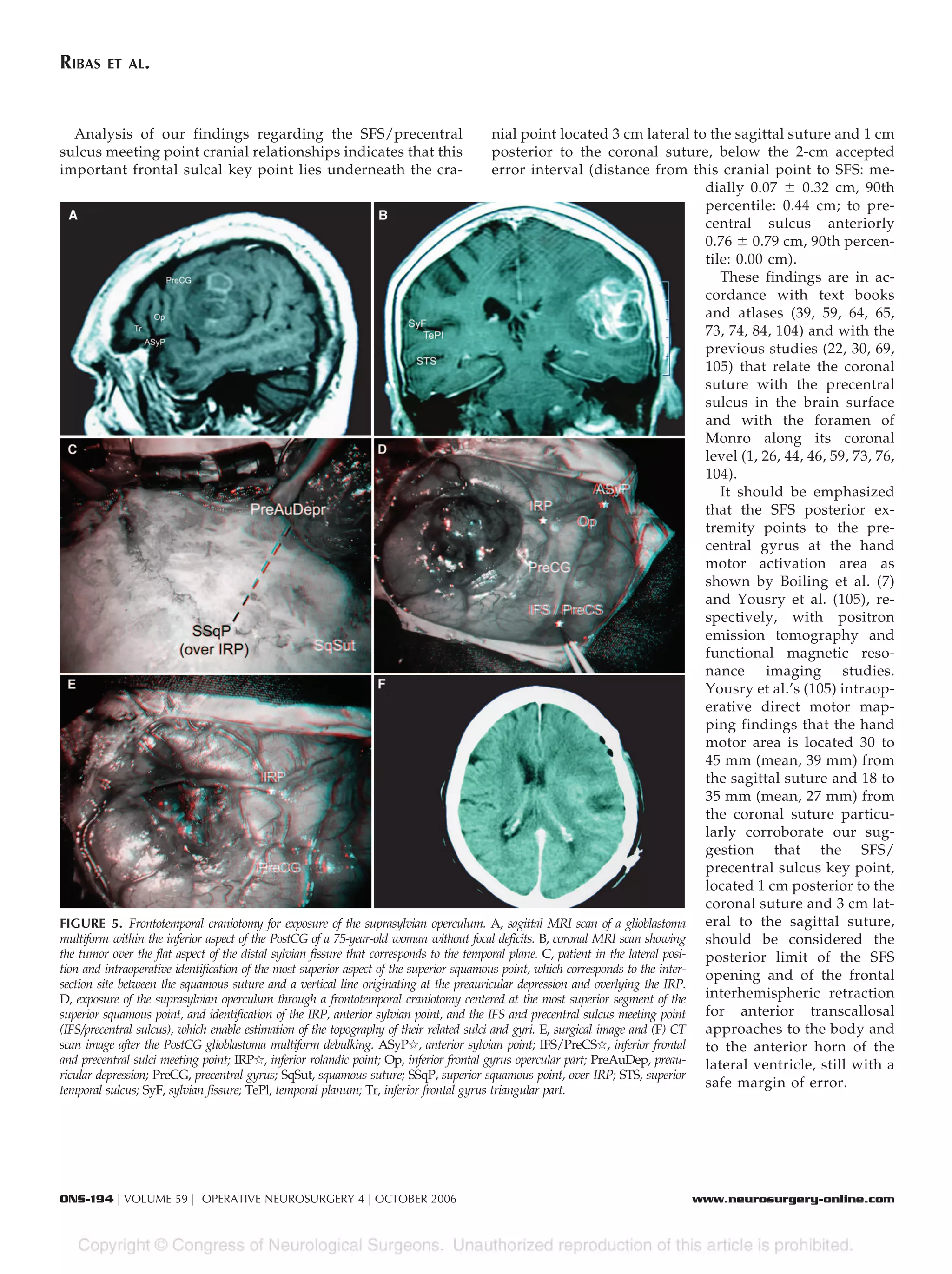 Surgical anatomy of microsurgical sulcal key points | PDF
