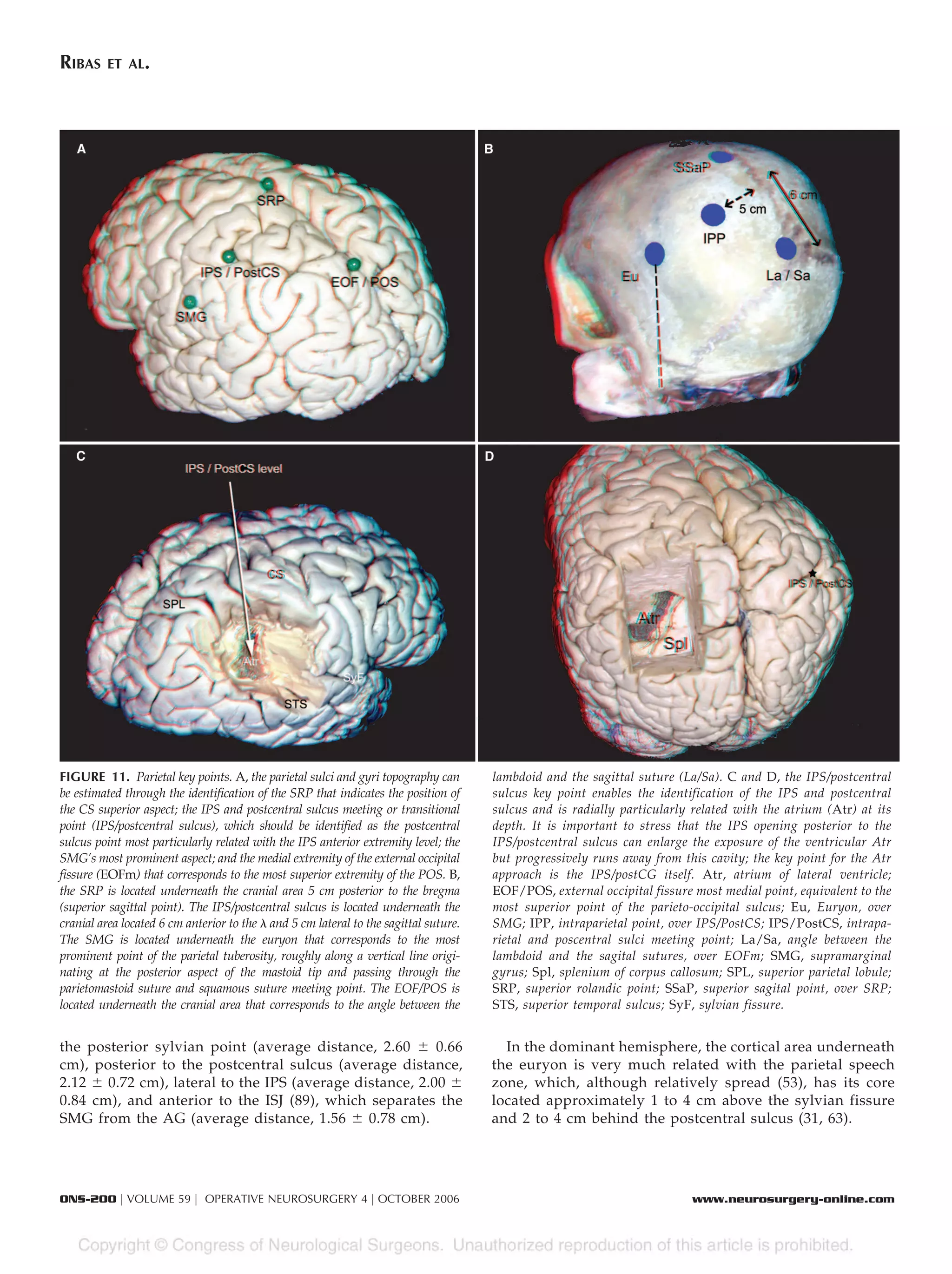 Surgical anatomy of microsurgical sulcal key points | PDF