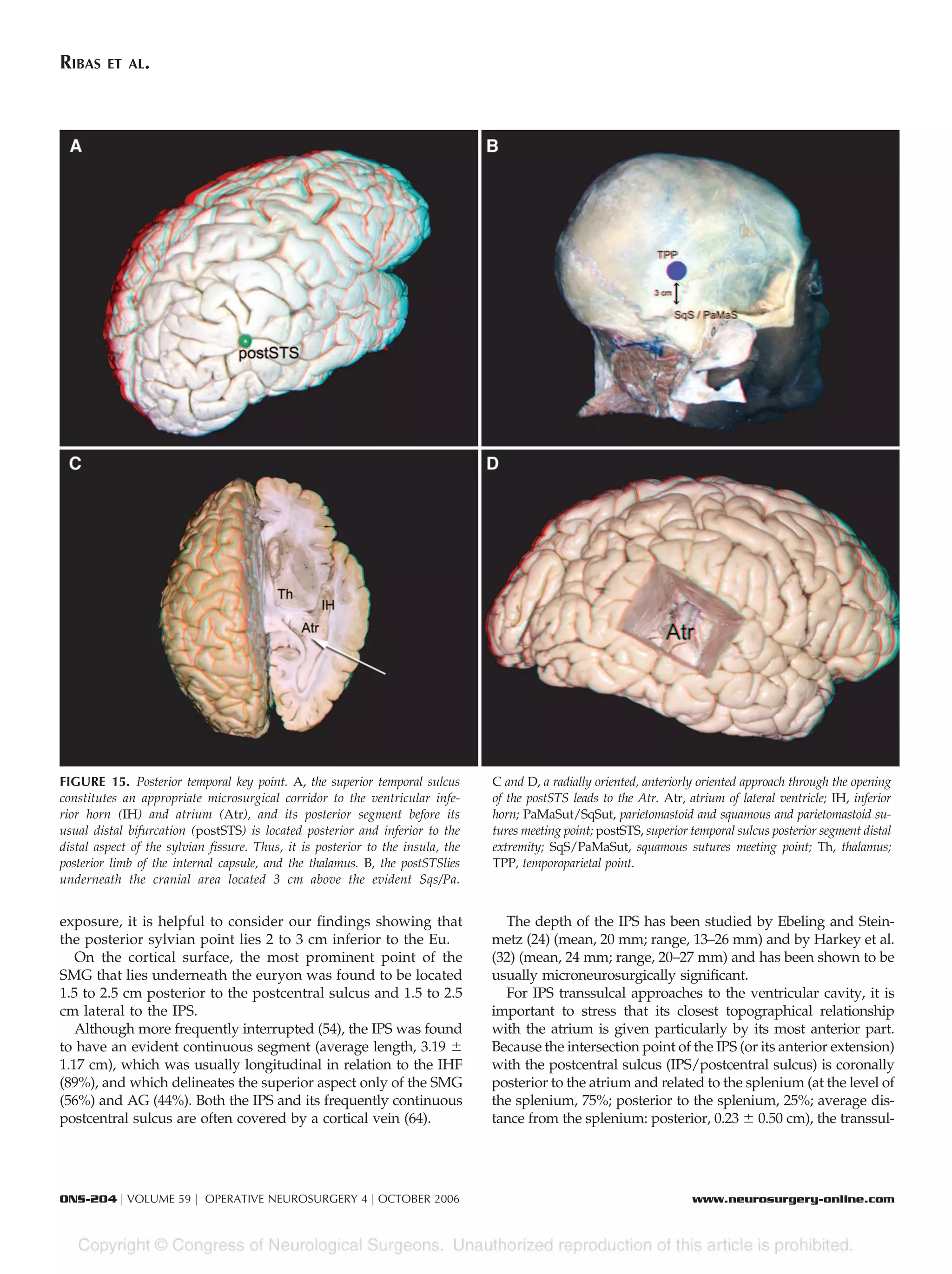 Surgical anatomy of microsurgical sulcal key points | PDF