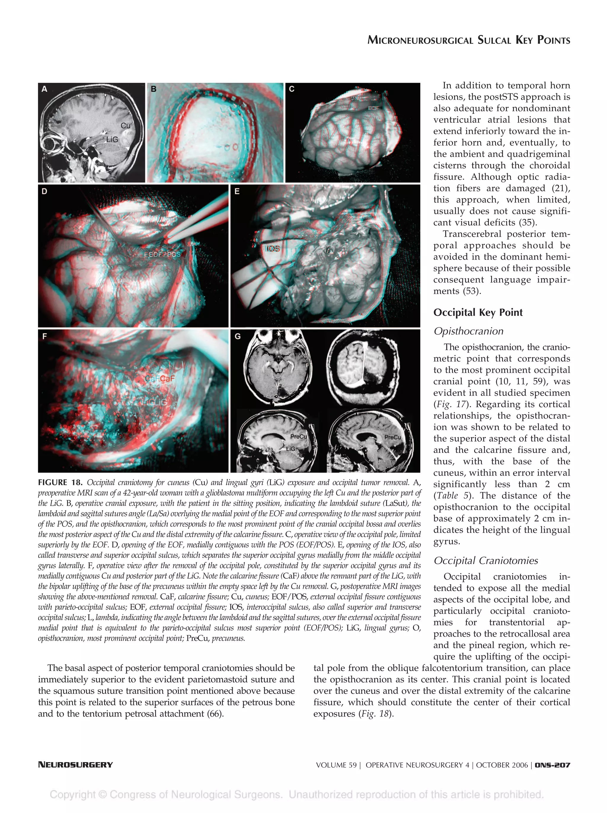 Surgical anatomy of microsurgical sulcal key points | PDF