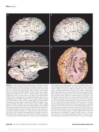 Surgical anatomy of microsurgical sulcal key points | PDF