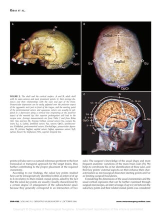 Surgical anatomy of microsurgical sulcal key points | PDF