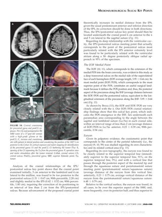Surgical anatomy of microsurgical sulcal key points | PDF