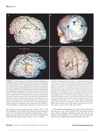 Surgical anatomy of microsurgical sulcal key points | PDF