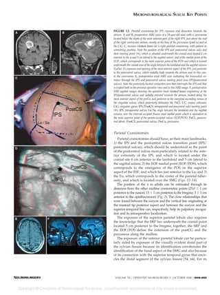 Surgical anatomy of microsurgical sulcal key points | PDF