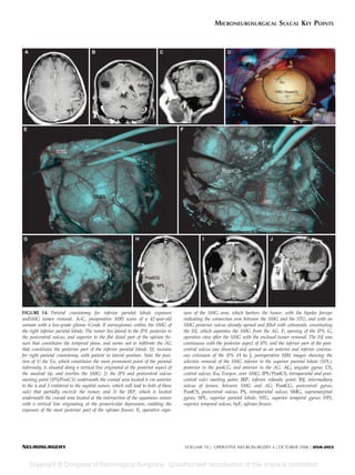 Surgical anatomy of microsurgical sulcal key points | PDF