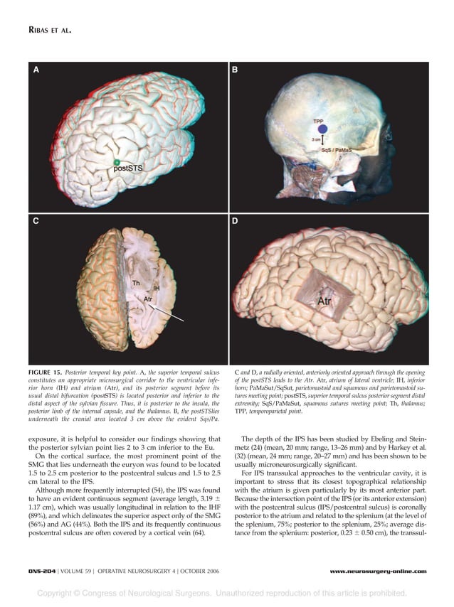 Surgical anatomy of microsurgical sulcal key points | PDF