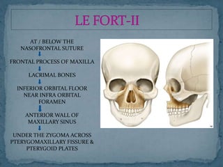 SURGICAL ANATOMY OF MID FACE.pptx