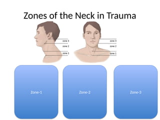 Surgical_Anatomy_of_Neck_and_Trauma_Management.pptx