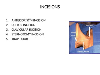 Surgical_Anatomy_of_Neck_and_Trauma_Management.pptx