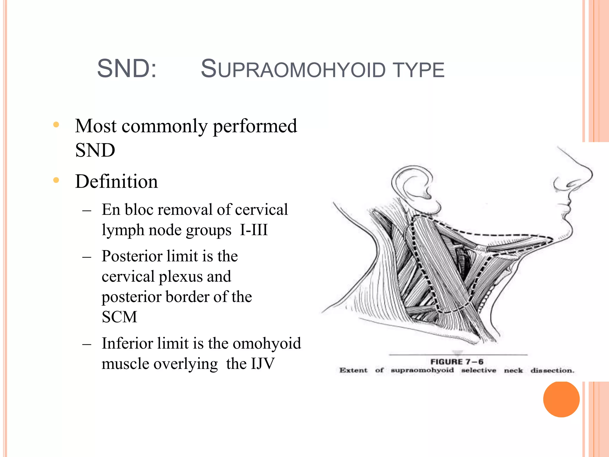 Surgical anatomy of neck and types of neck dissection | PPTX