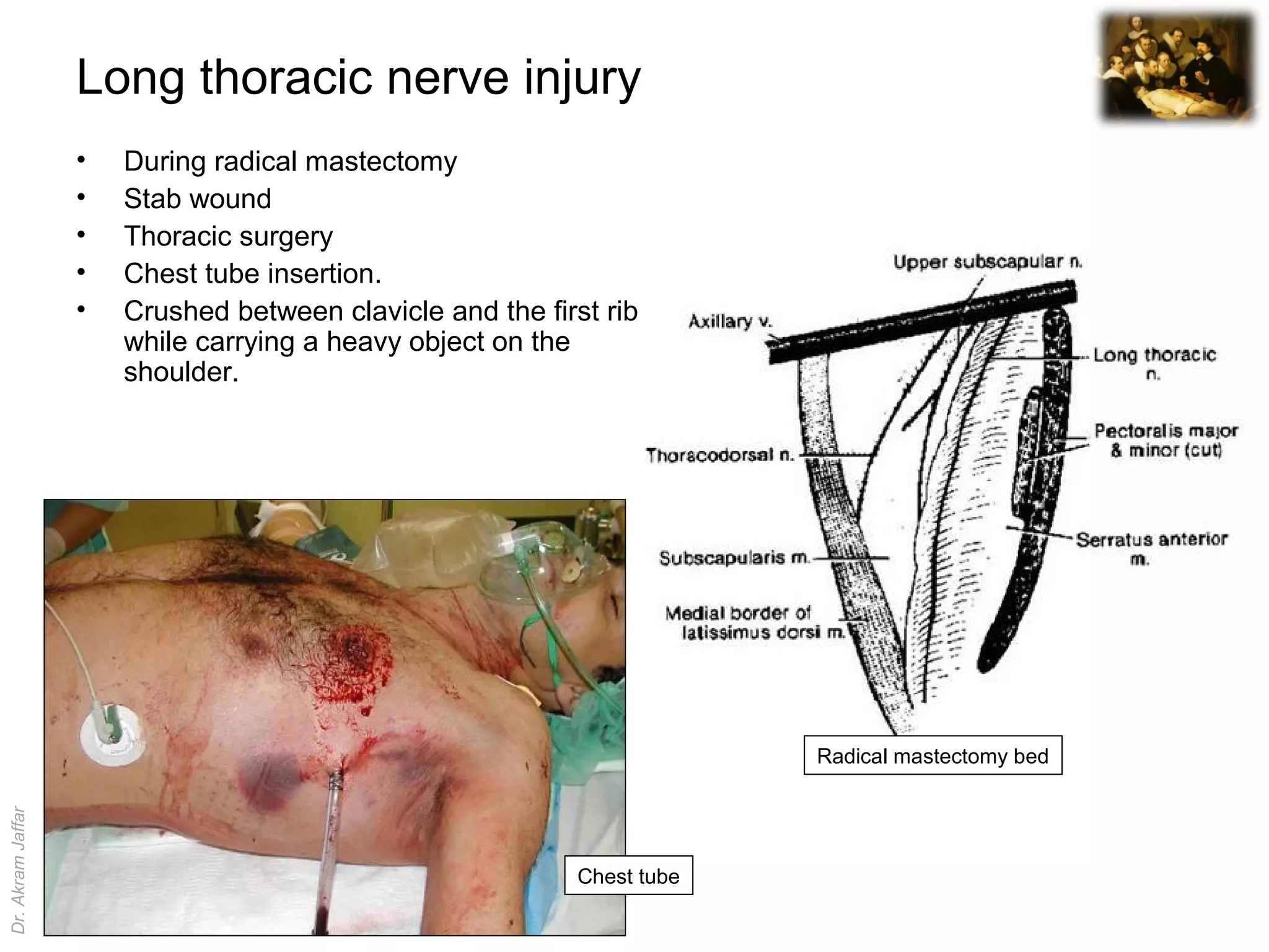 Surgical anatomy of nerve and vascular injuries in the upper limb | PPT