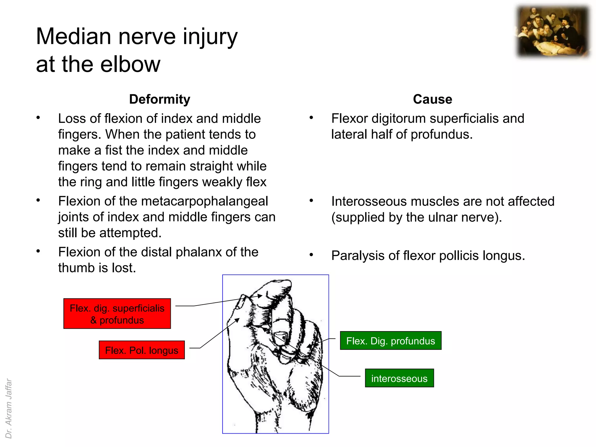 Surgical anatomy of nerve and vascular injuries in the upper limb | PPT