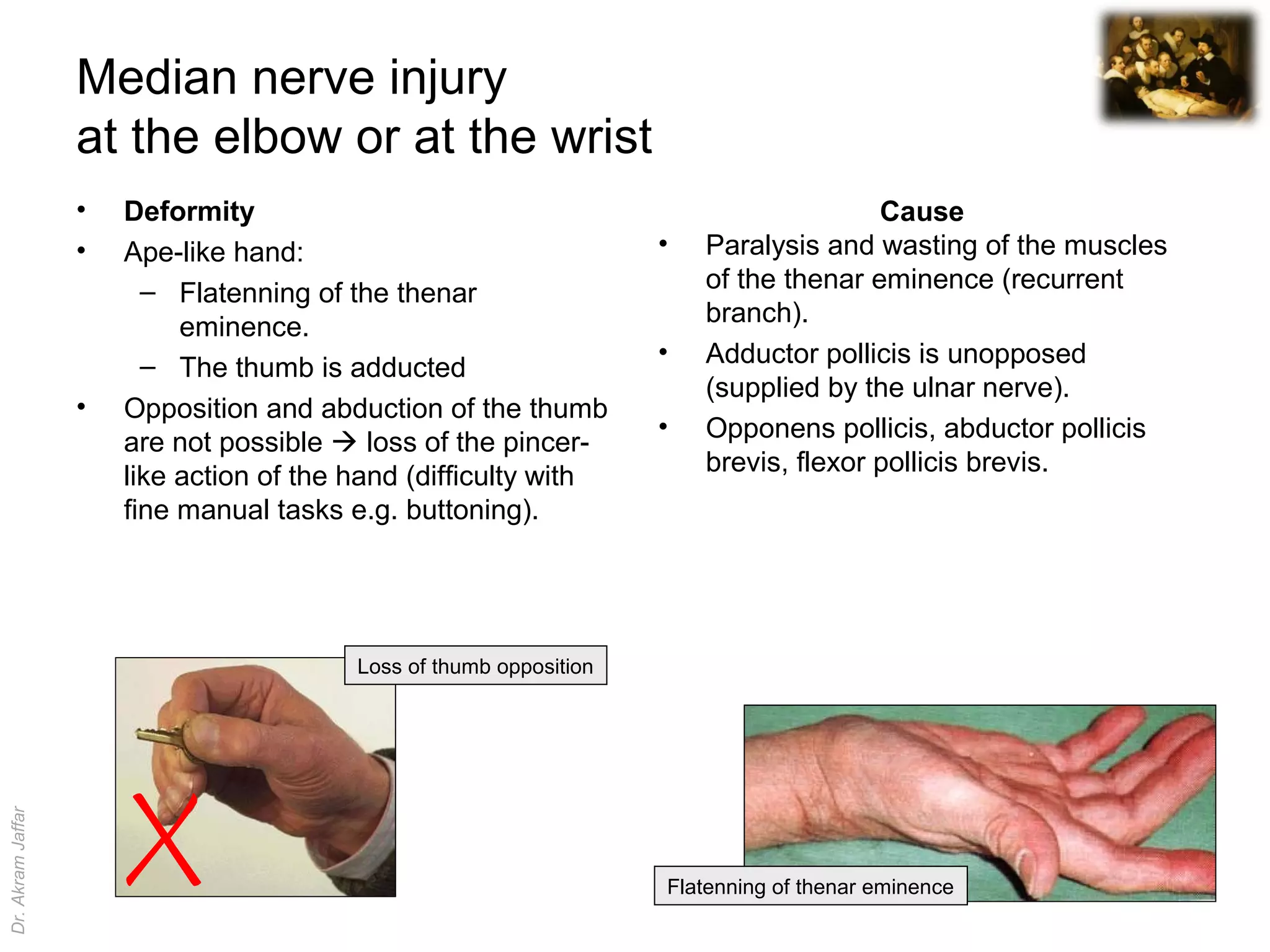 Surgical anatomy of nerve and vascular injuries in the upper limb | PPT