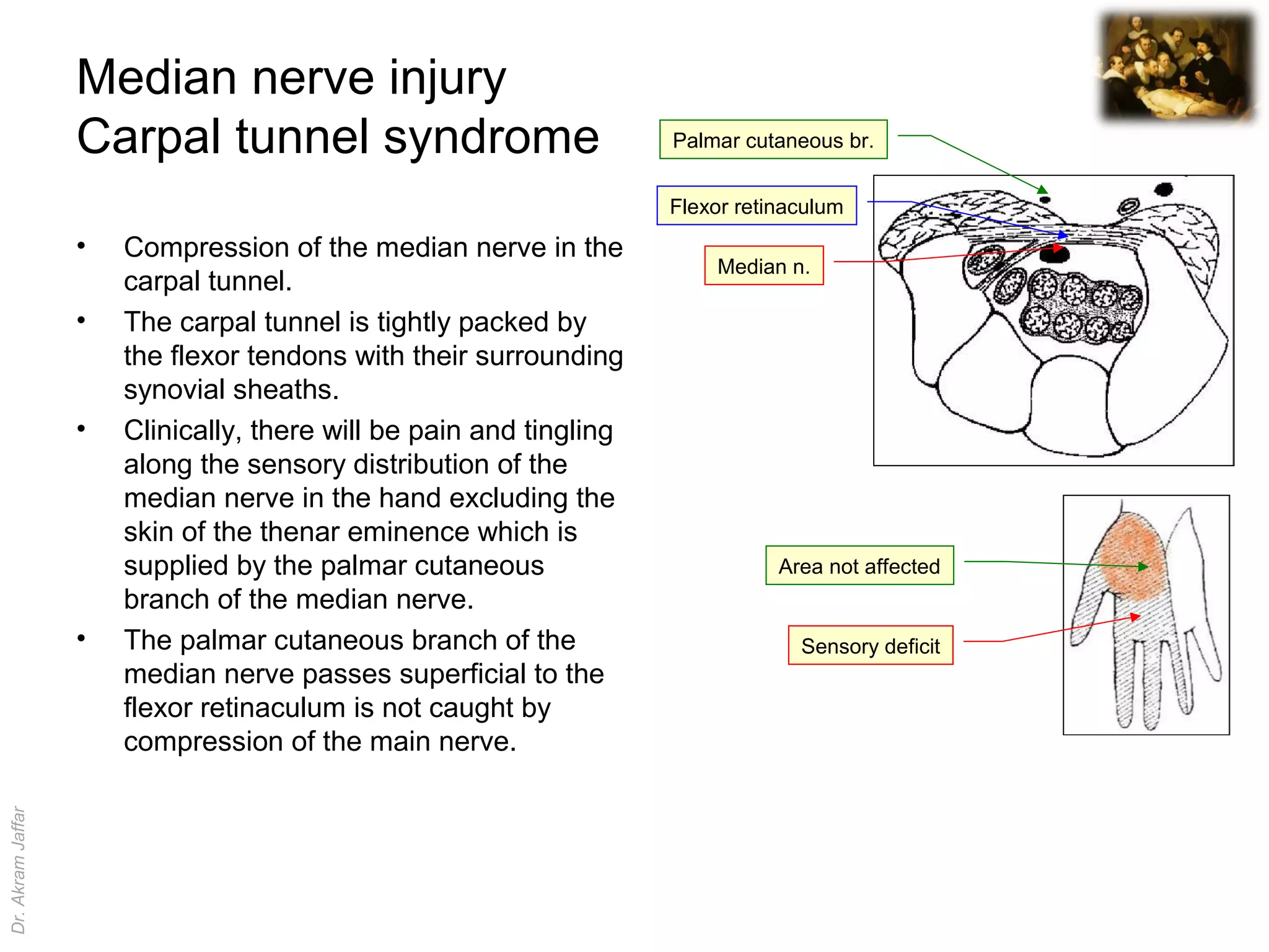 Surgical anatomy of nerve and vascular injuries in the upper limb | PPT