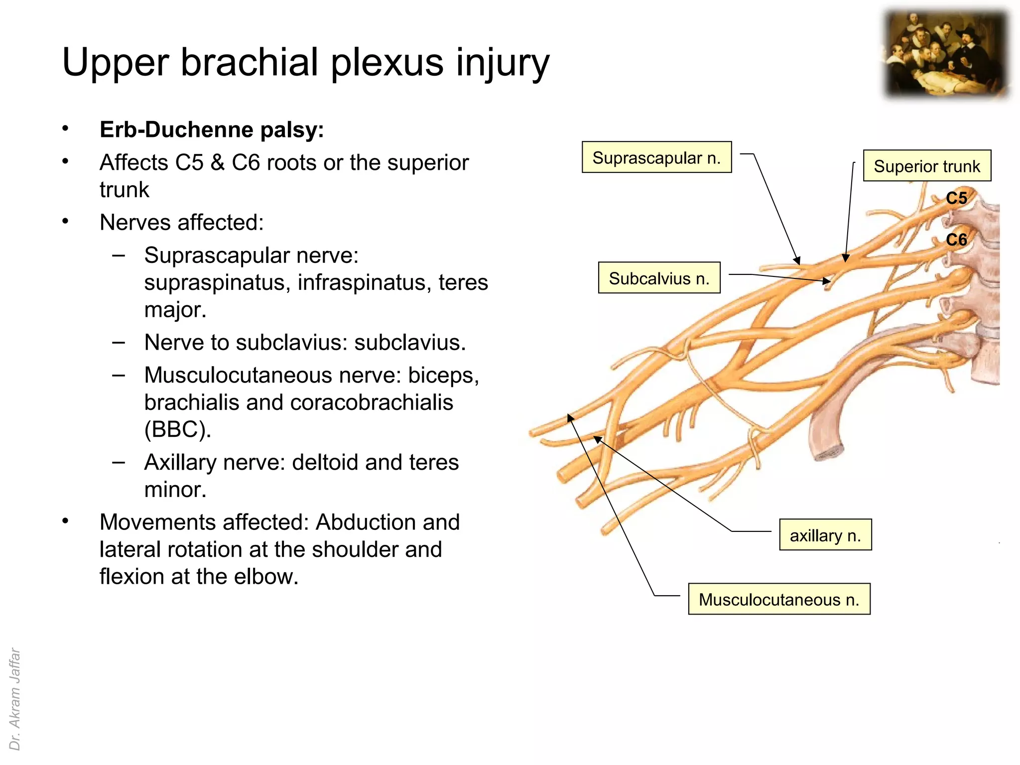 Surgical anatomy of nerve and vascular injuries in the upper limb | PPT