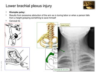 Surgical anatomy of nerve and vascular injuries in the upper limb | PPT