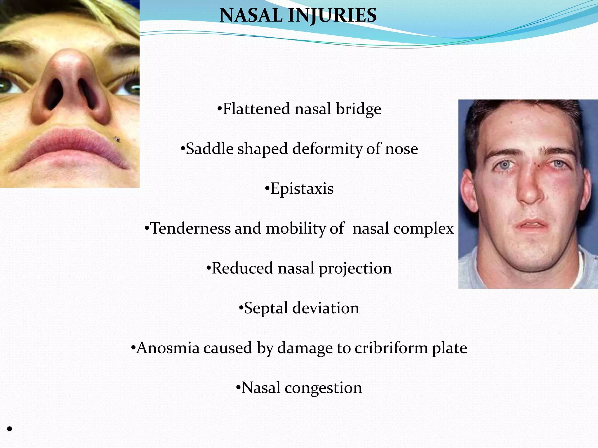 Surgical anatomy of Noe complex in context of trauma | PPTX
