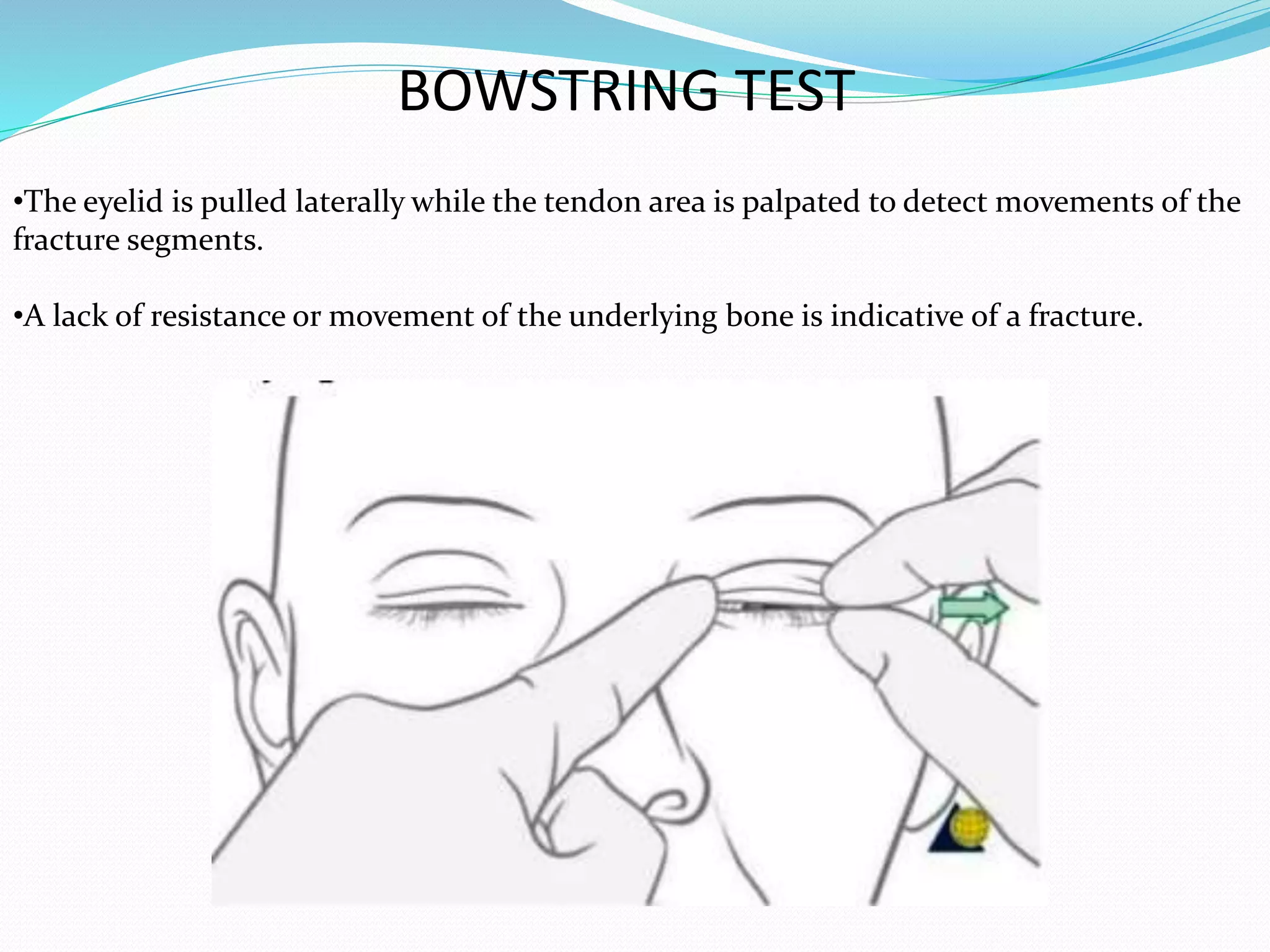 Surgical anatomy of Noe complex in context of trauma | PPTX