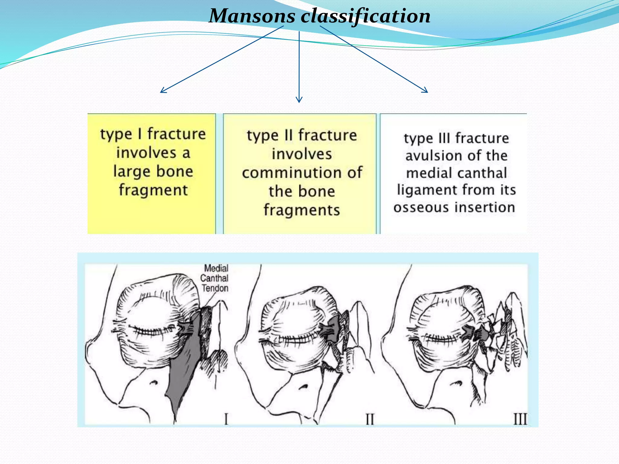 Surgical anatomy of Noe complex in context of trauma | PPTX