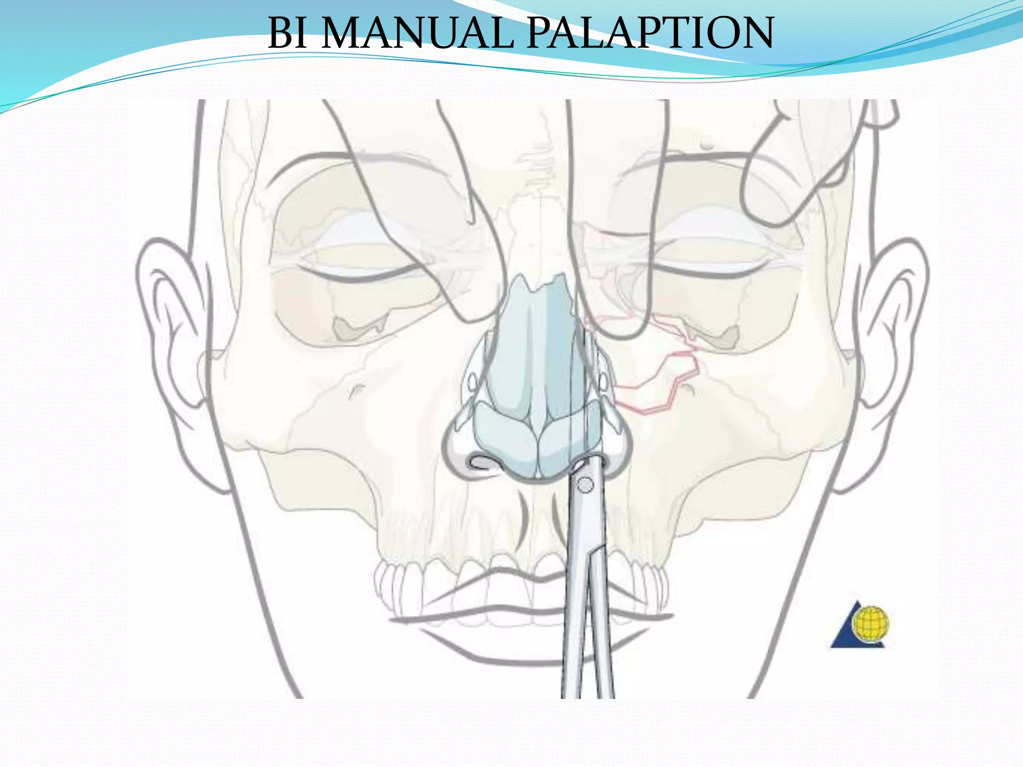 Surgical anatomy of Noe complex in context of trauma | PPTX