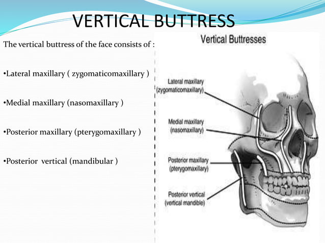 Surgical anatomy of Noe complex in context of trauma | PPT