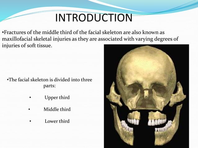 Surgical anatomy of Noe complex in context of trauma | PPT