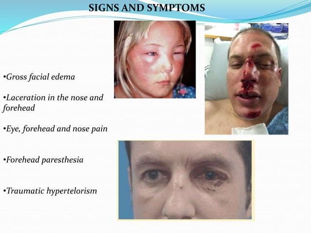 Surgical anatomy of Noe complex in context of trauma | PPT