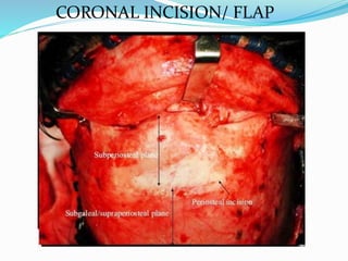 Surgical anatomy of Noe complex in context of trauma | PPTX