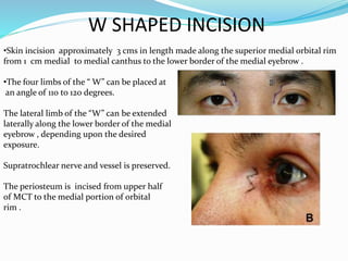Surgical anatomy of Noe complex in context of trauma | PPTX