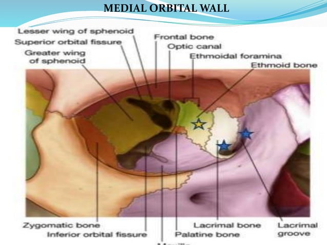 Surgical anatomy of Noe complex in context of trauma | PPT
