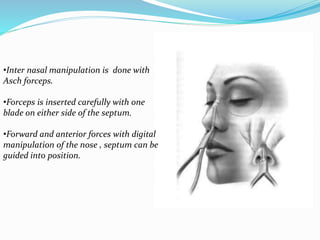 Surgical anatomy of Noe complex in context of trauma | PPT