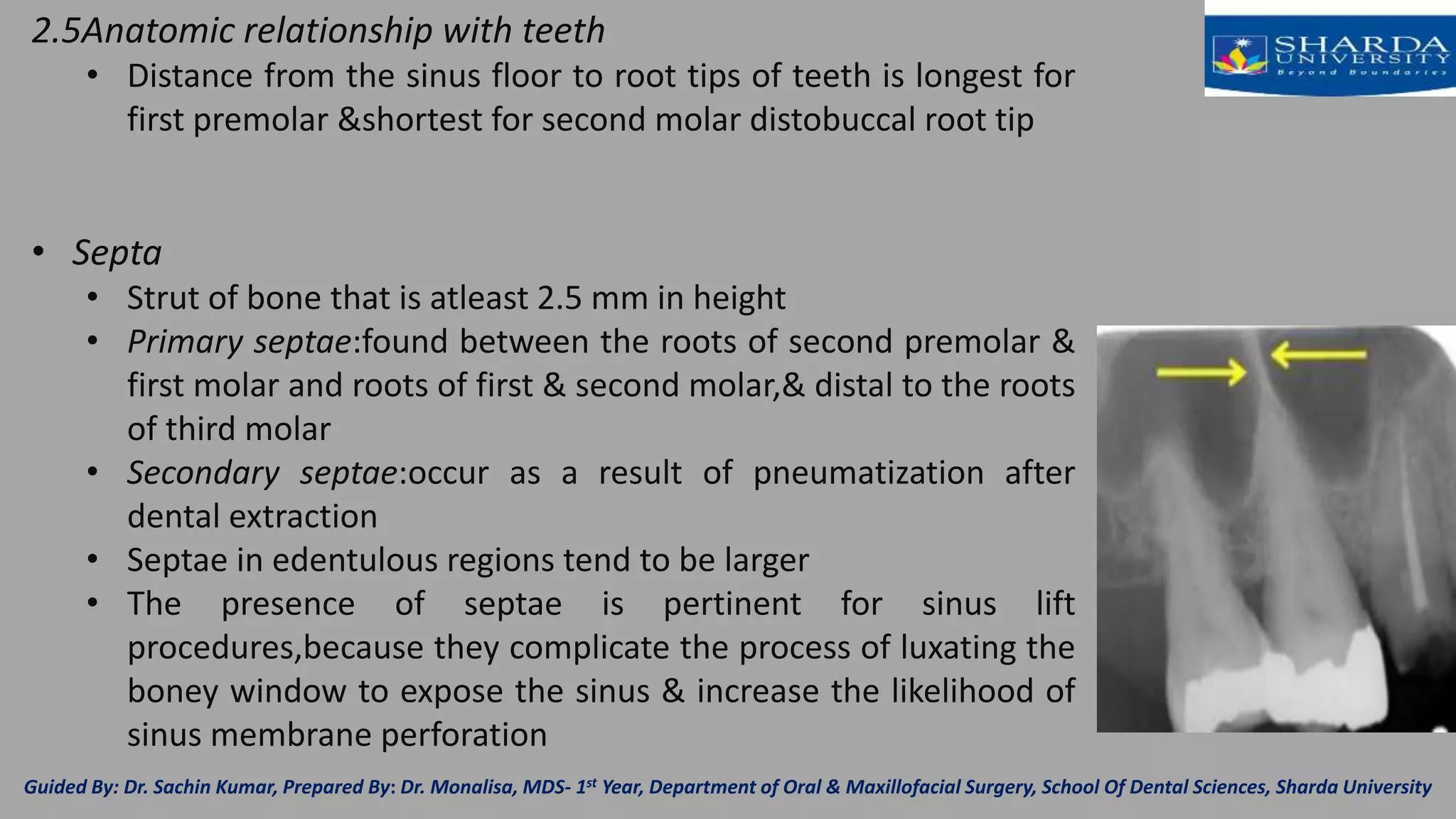 Surgical anatomy of nose and maxilliary sinus.pptx [autosaved] | PPTX
