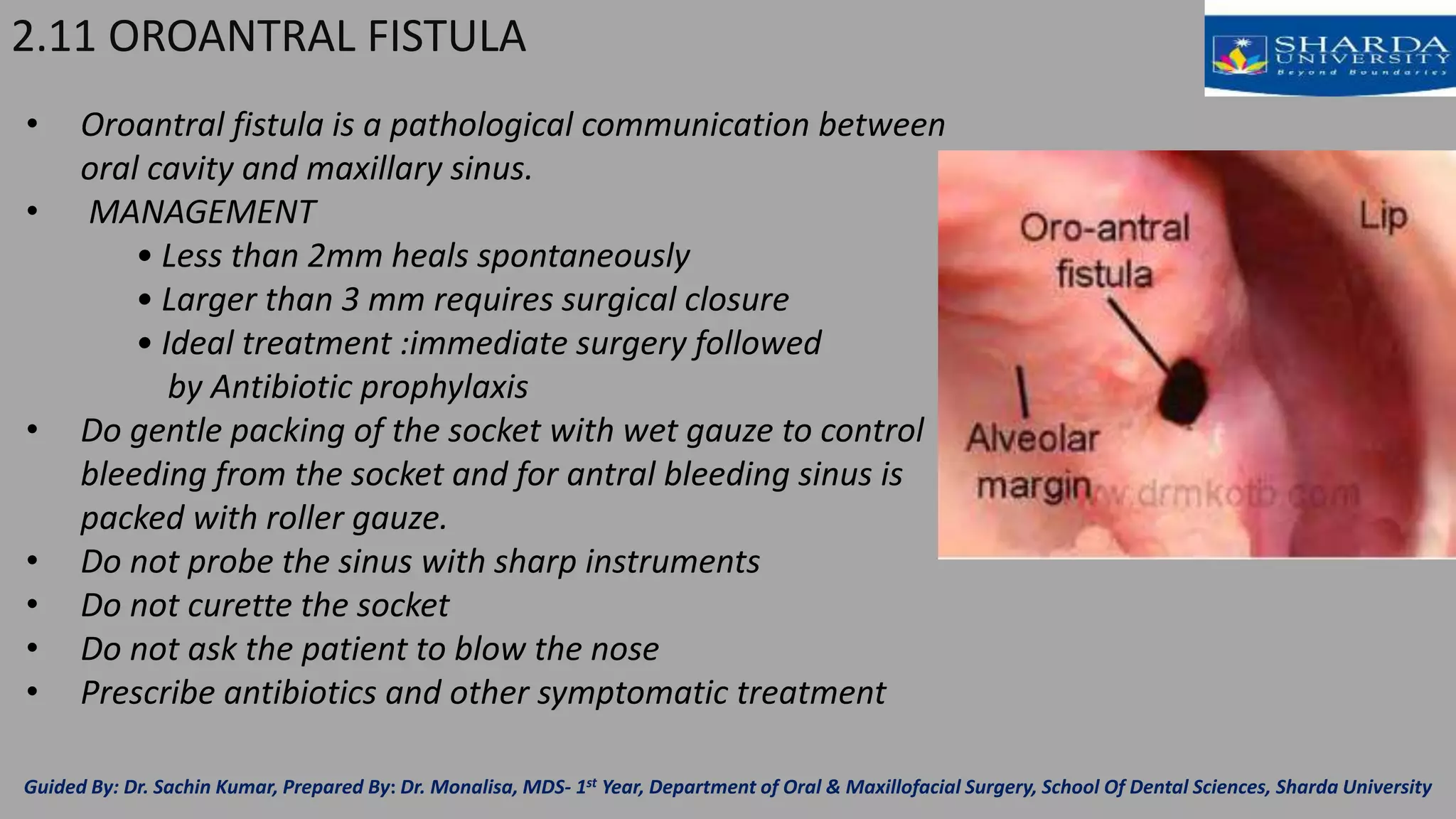 Surgical anatomy of nose and maxilliary sinus.pptx [autosaved] | PPTX
