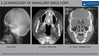 Surgical anatomy of nose and maxilliary sinus.pptx [autosaved] | PPTX