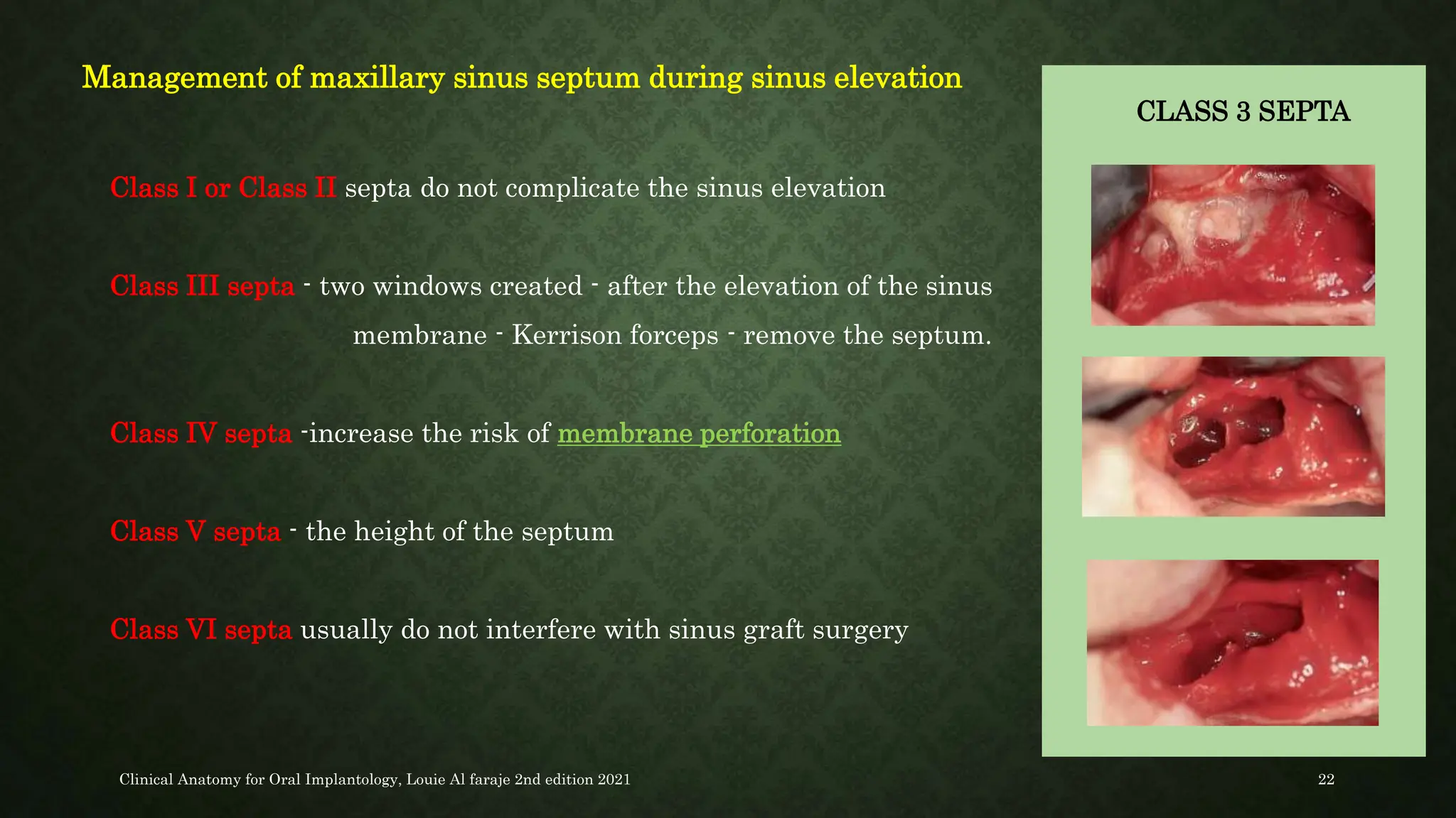 SURGICAL ANATOMY OF ORAL IMPLANTOLOGY.pptx