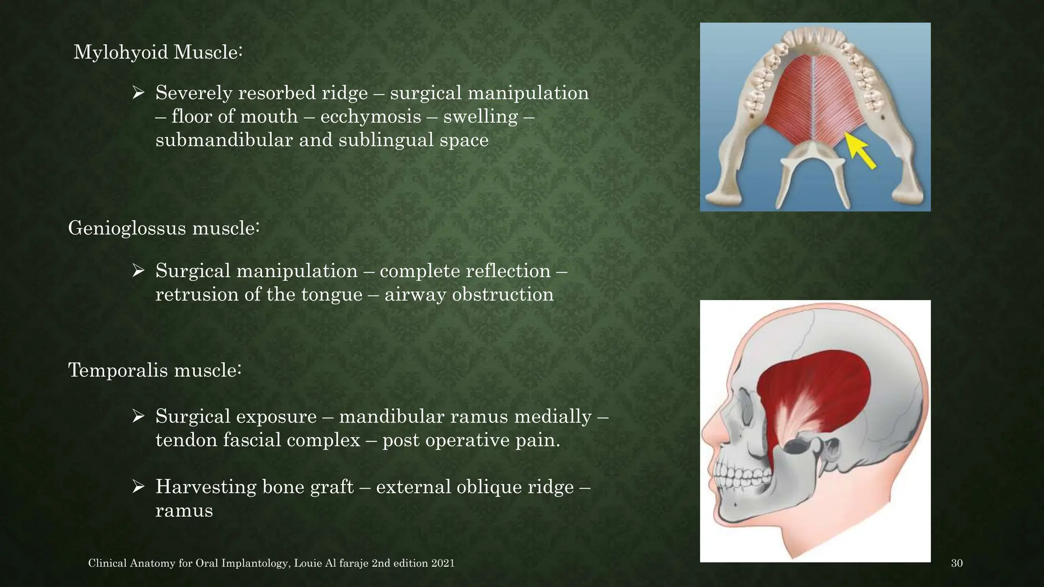 SURGICAL ANATOMY OF ORAL IMPLANTOLOGY.pptx