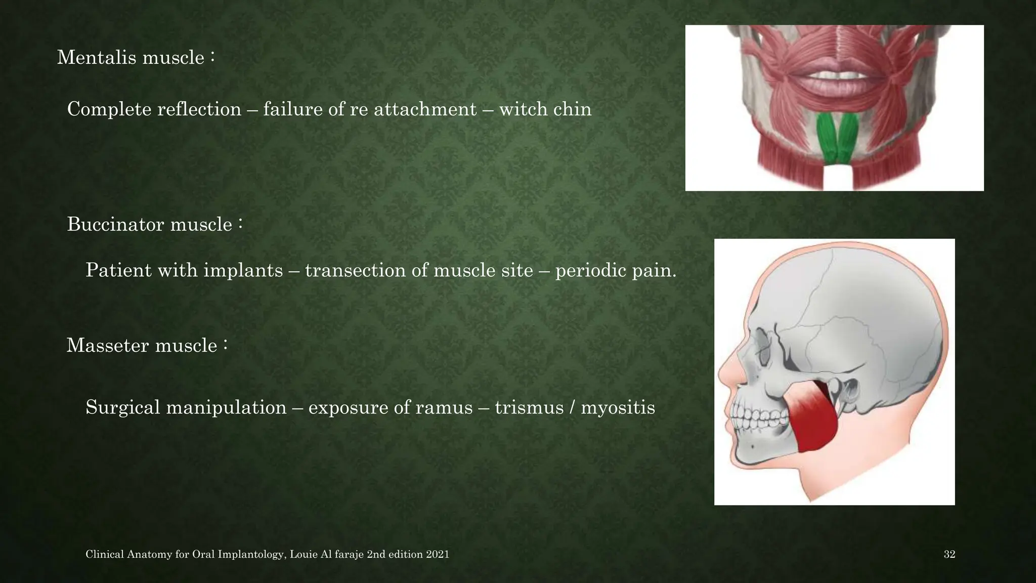 SURGICAL ANATOMY OF ORAL IMPLANTOLOGY.pptx
